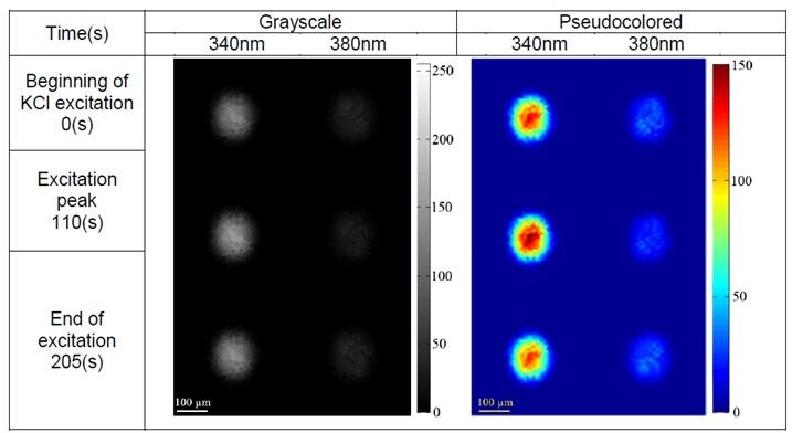 Calcium Detection - I2Sense | I2Sense Laboratory | University of ...