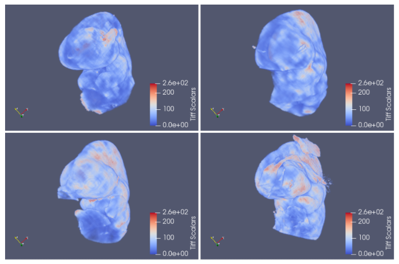 Fully automatic segmentation and quantification of lightsheet ...