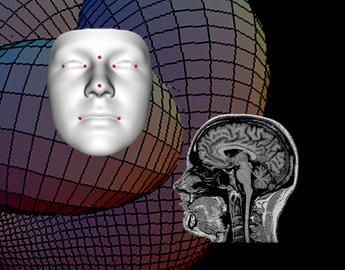 Research | MIPLab | Medical Image Processing and Machine Learning ...